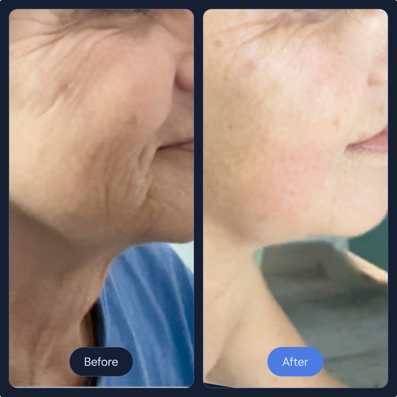 Cryotherapy Results | Before & After Skin & Body – America Cryo