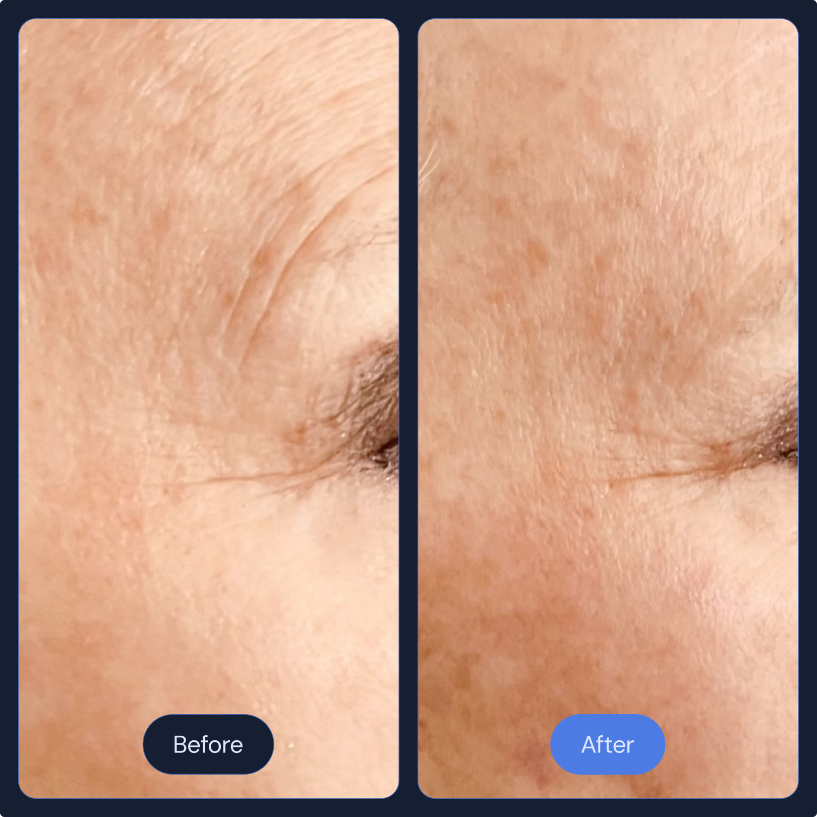 Cryotherapy Results | Before & After Skin & Body – America Cryo